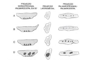 Síndrome do Navicular - Sinais Clínicos e Tratamento | Blog Equinovet